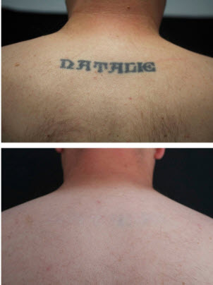 Ardmore Tattoos